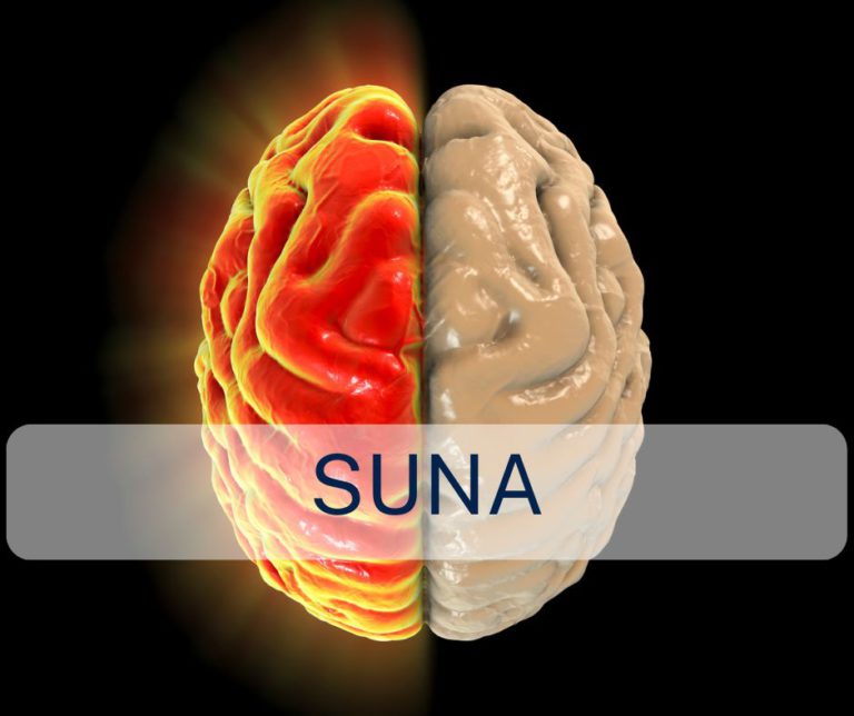 Suna - Giorgio Lambru - headache and facial pain specialist
